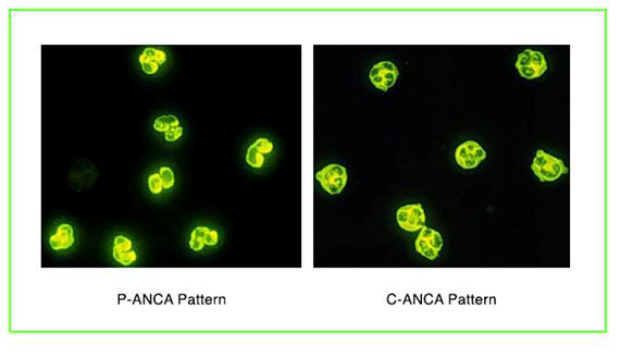 ANCA (IFA Method) | RT Diagnostics