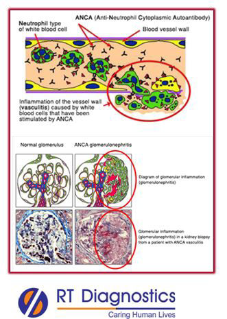 ANCA (IFA Method) | RT Diagnostics