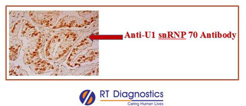 Antibody Ui-Sn-Rnp | RT Diagnostics