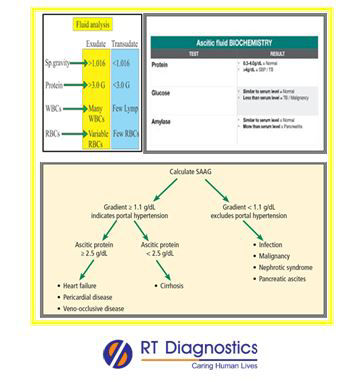 Ascitic Fluid For Protein | RT Diagnostics