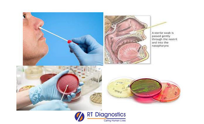 Culture & Sensitivity - Nasal Swab | RT Diagnostics