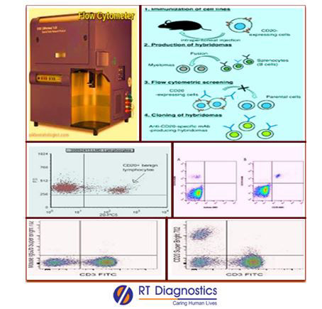 CD -20 Flow Cytometry | RT Diagnostics