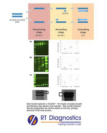 Cytomegalovirus (CMV - DNA Qualitative RT-PCR) | RT Diagnostics