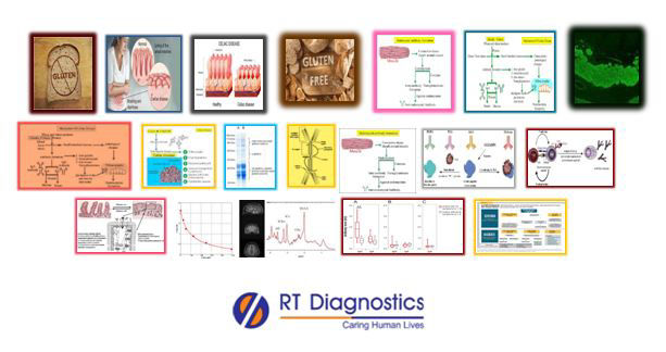 Tissue Transglutaminase IgA | RT Diagnostics