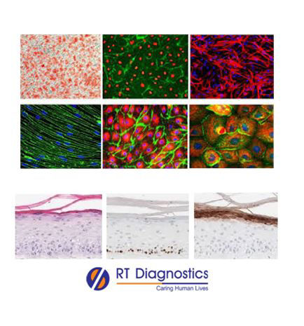 Culture & Sensitivity - Tissue | RT Diagnostics