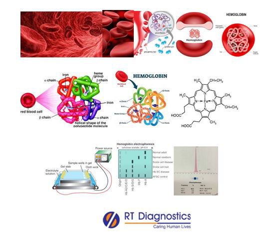 Haemoglobin (Hb) Electrophoresis | RT Diagnostics