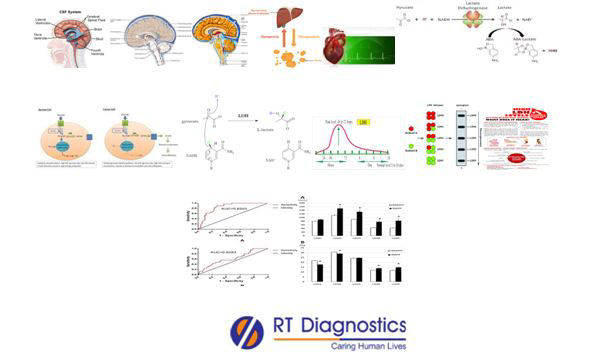 LDH - CSF | RT Diagnostics