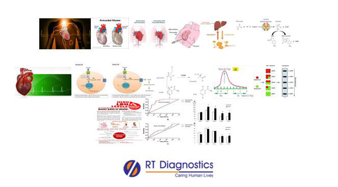 LDH - Pericardial Fluid | RT Diagnostics