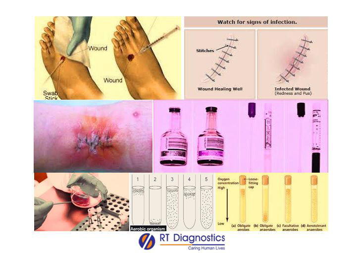 Culture & Sensitivity - OT Swab (Aerobic) | RT Diagnostics