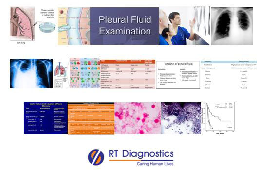 Pleural Fluid Analysis | RT Diagnostics