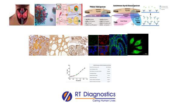 Thyroglobulin Ab (ATG) | RT Diagnostics