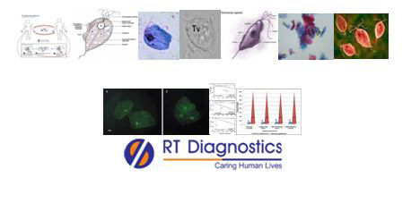 Trichomonas Vaginalis ( DNA Qualitative RT - PCR ) | RT Diagnostics