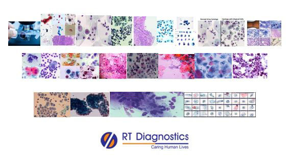 Urine Cytology | RT Diagnostics